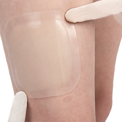 What Is Moist Wound Dressing? -advanced Wound Dressing Types | Huawei